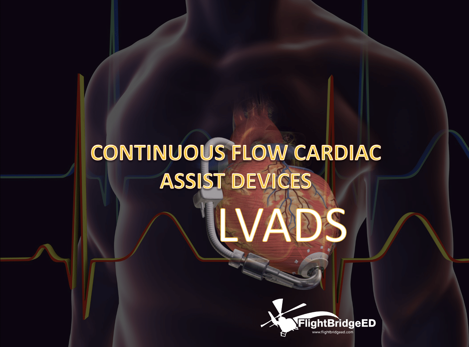 CONTINUOUS FLOW CARDIAC ASSIST DEVICES: LVADS – FlightBridgeED